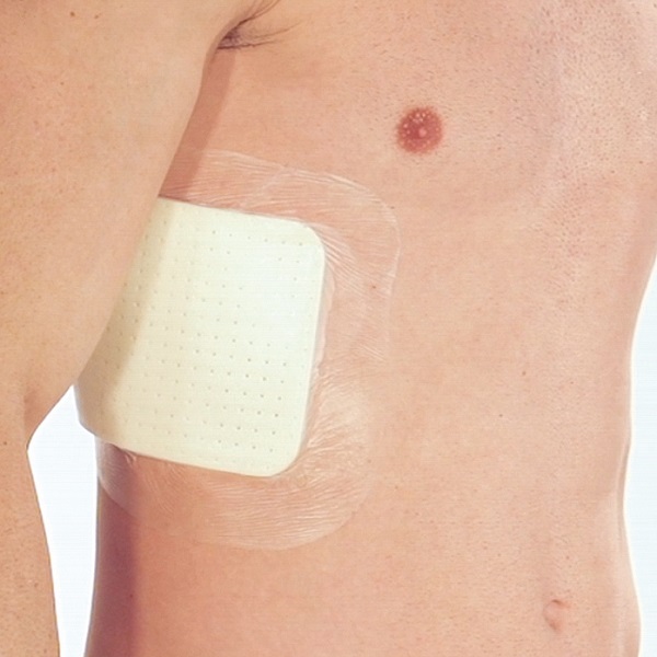 Vente en ligne de Fracture costale CHRISOFIX Gibaud Orthèse thoracique ...